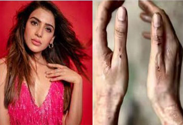 Samantha Ruth Prabhu suffers injury while shooting Citadel India - Newspulse